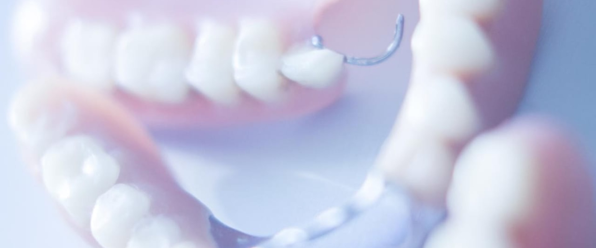 What A Dental Assistant Can Do To Assist Your Dentist During Invisalign ...